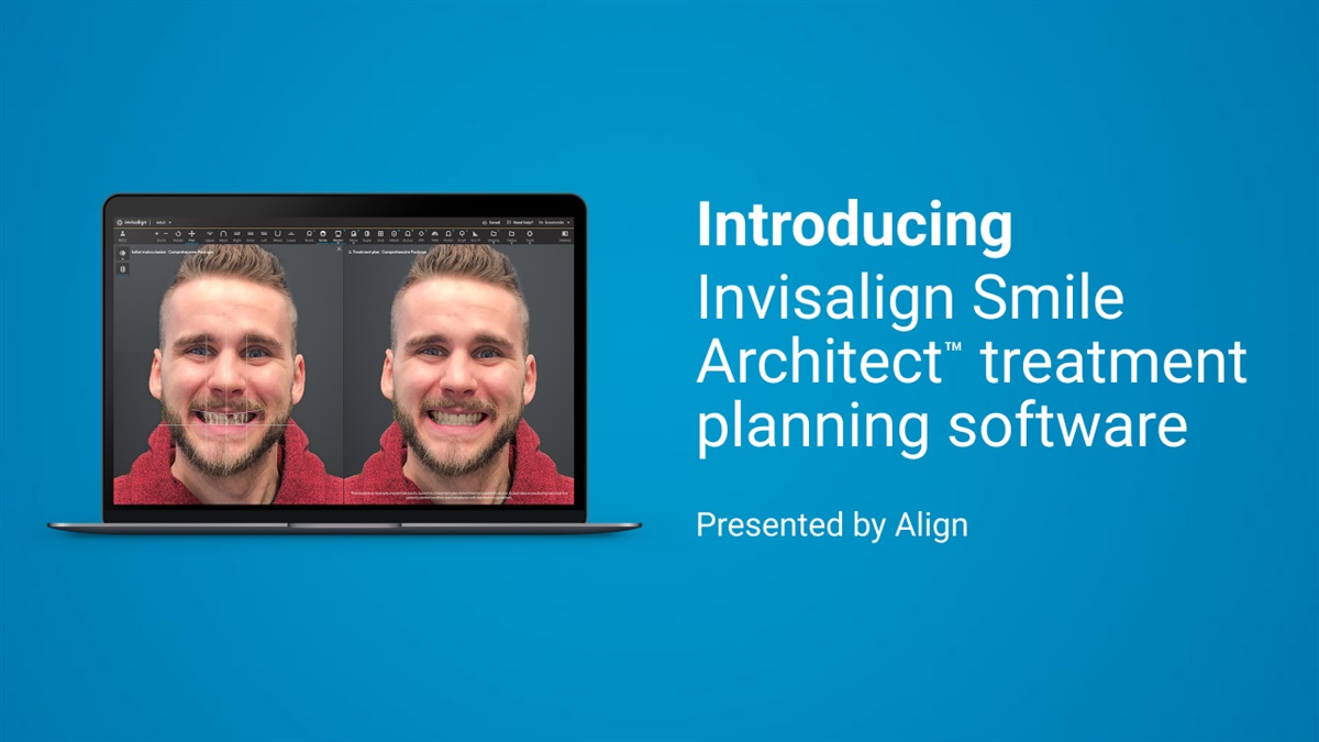 Invisalign Smile Architect™ treatment planning software - Dental ...