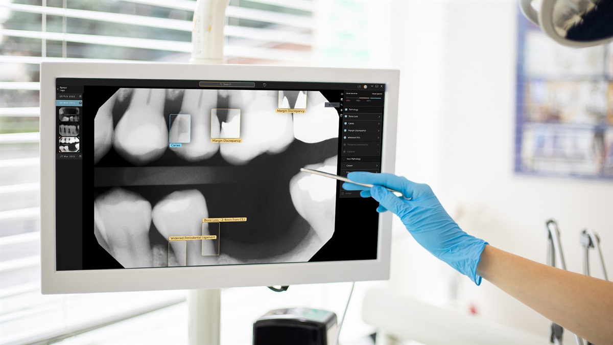FDA Clears AI Software to Read Dental X-Rays - Dental Industry News ...