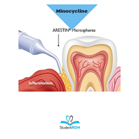 What is the active ingredient of Arestin? - National Dental Hygiene ...