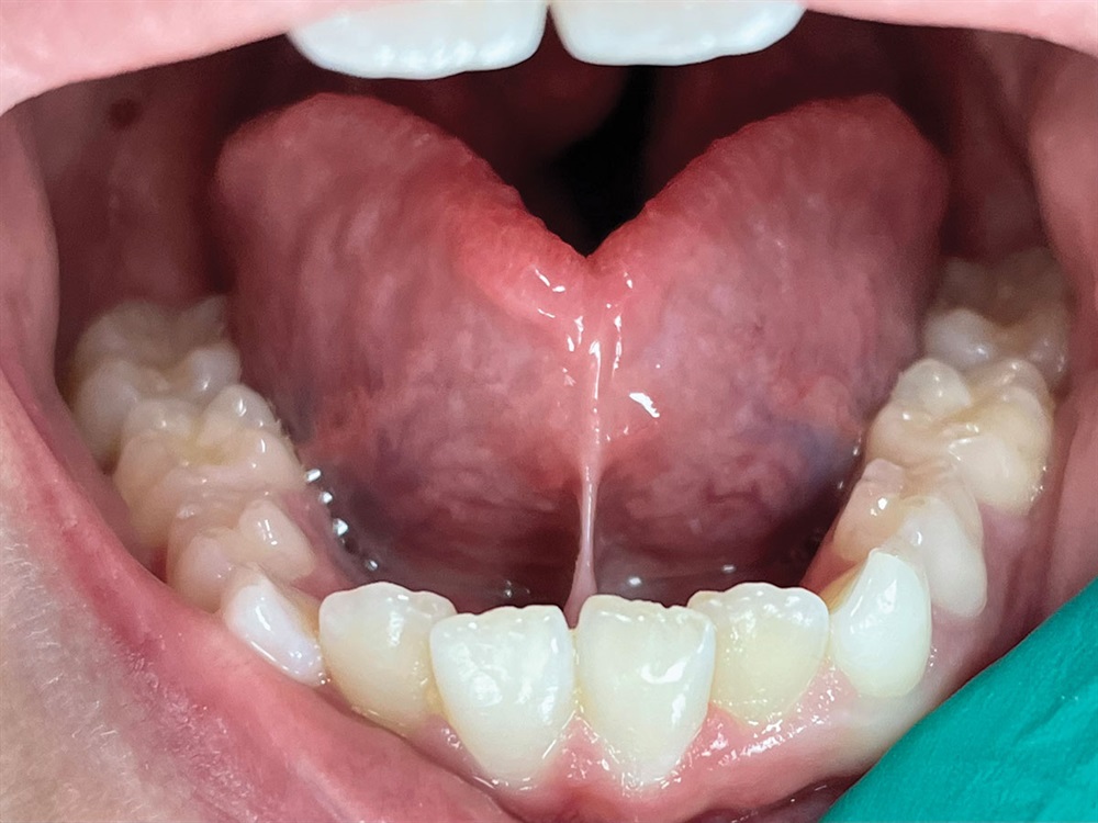 Cutting the Ties That Bind by Dr. Ben Curtis - Dentaltown