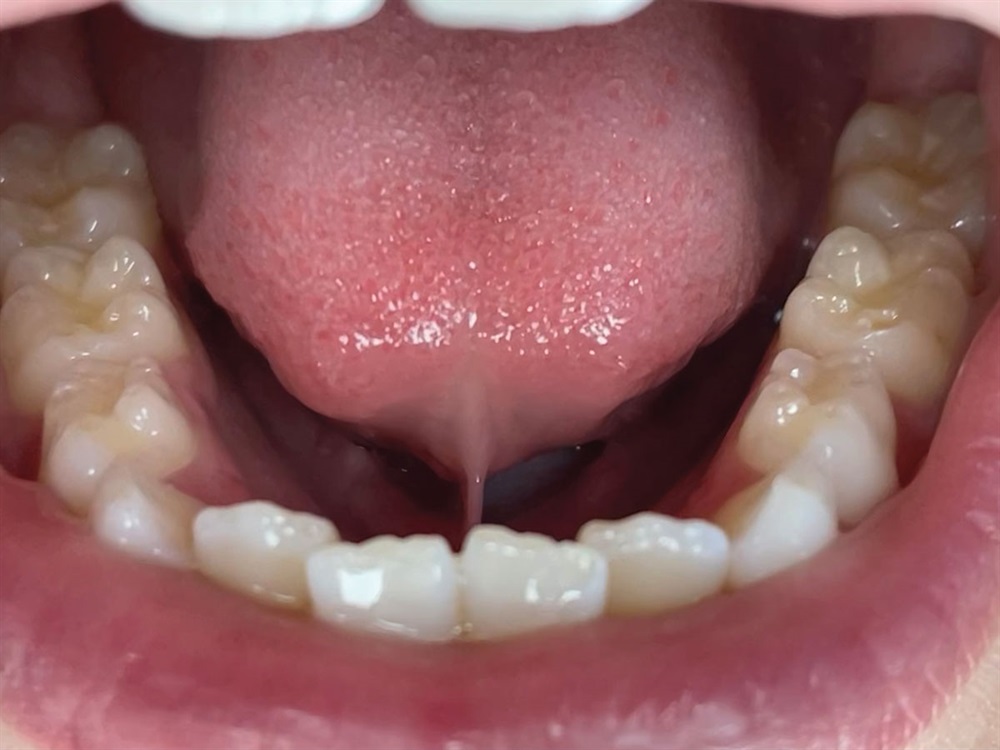 Cutting the Ties That Bind by Dr. Ben Curtis - Dentaltown