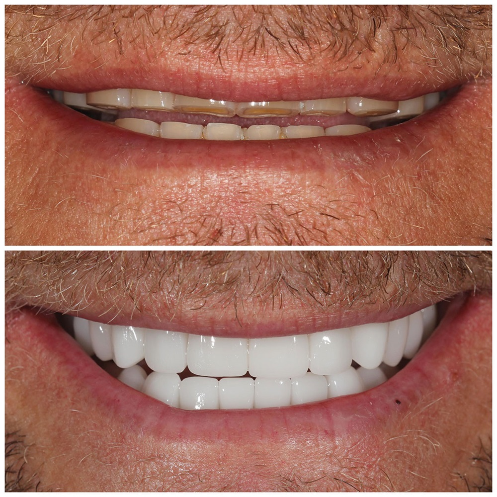 Office Visit: Dr. Grant Olson by Sam Mittelsteadt, editor - Dentaltown