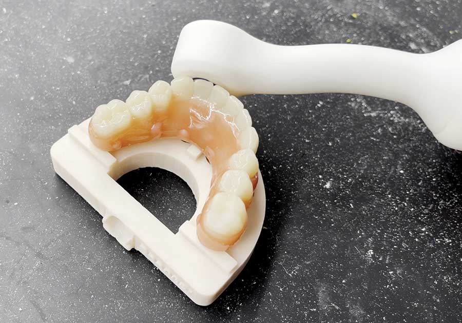 Creating an Affordable, Aesthetic Same-Day Full-Arch Prosthetic by Dr ...
