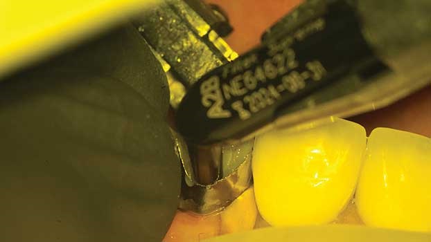 Show Your Work: Strike Up the Band! by Dr. Arthur R. Volker - Dentaltown