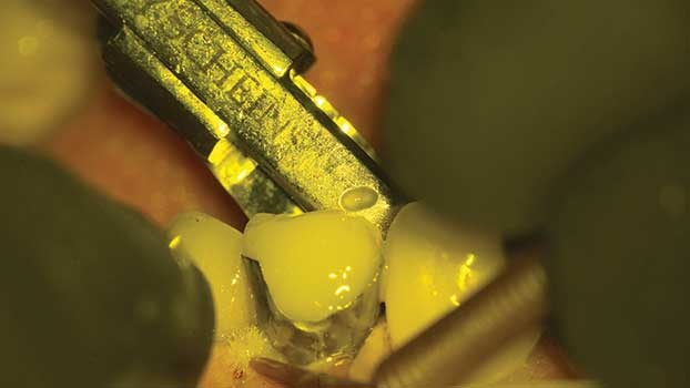 Show Your Work: Strike Up the Band! by Dr. Arthur R. Volker - Dentaltown