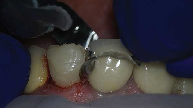 Show Your Work: Strike Up the Band! by Dr. Arthur R. Volker - Dentaltown