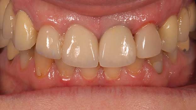 Show Your Work: Strike Up the Band! by Dr. Arthur R. Volker - Dentaltown