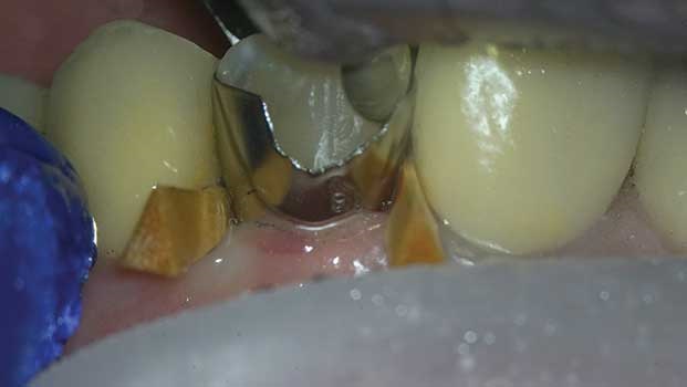 Show Your Work: Strike Up the Band! by Dr. Arthur R. Volker - Dentaltown