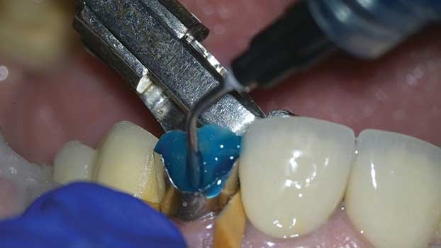 Show Your Work: Strike Up the Band! by Dr. Arthur R. Volker - Dentaltown
