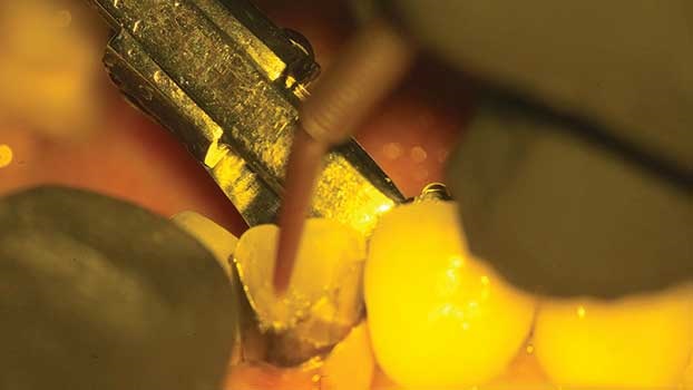 Show Your Work: Strike Up the Band! by Dr. Arthur R. Volker - Dentaltown