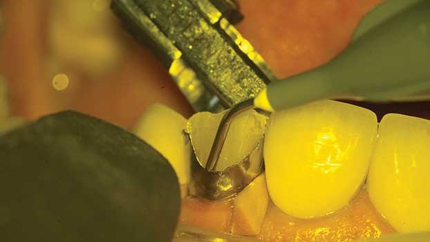 Show Your Work: Strike Up the Band! by Dr. Arthur R. Volker - Dentaltown