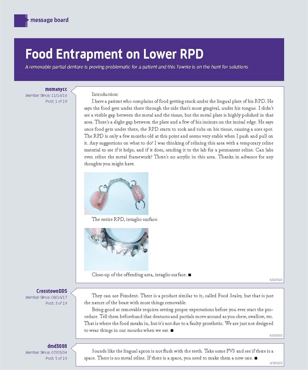 Food Entrapment on Lower RPD - Dentaltown