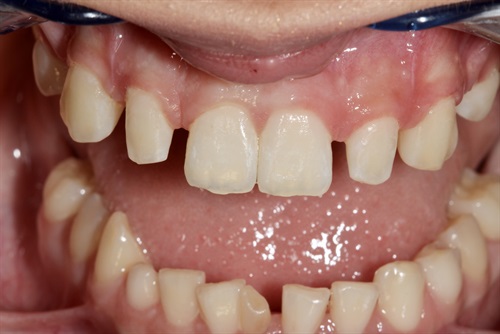 Dentaltown - Where The Dental Community Lives®