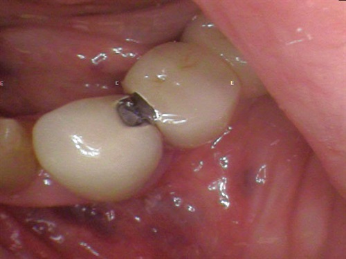 Dentaltown - Where The Dental Community Lives®