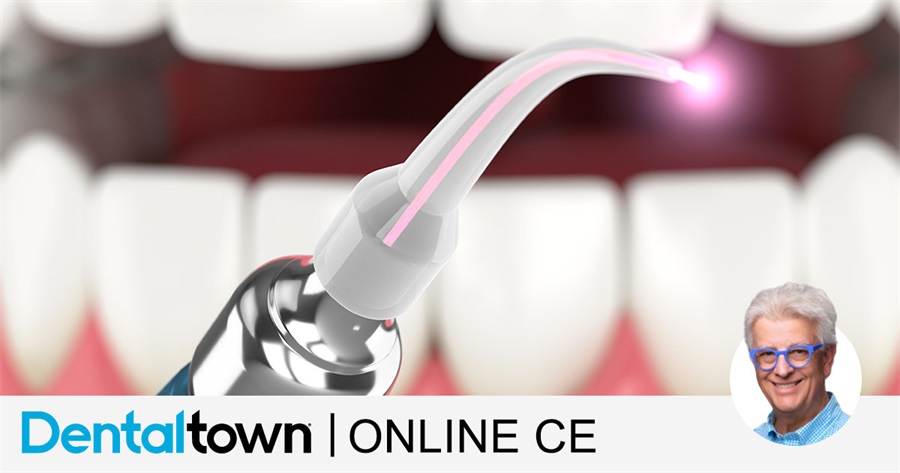 The Laser Advantage—Clinical Applications of Lasers in Endodontics ...